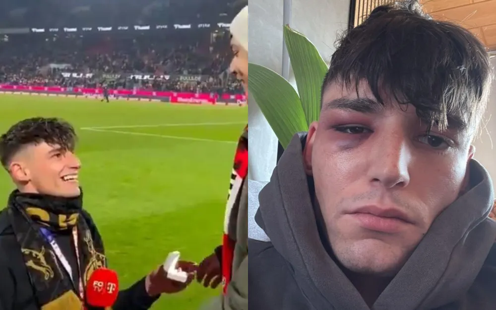 Germania, l'arbitro Pascal Kaiser picchiato sotto casa: una settimana ...